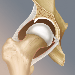 Hip Labral Tear Symptoms, Surgery & Treatment Melbourne | MOATI